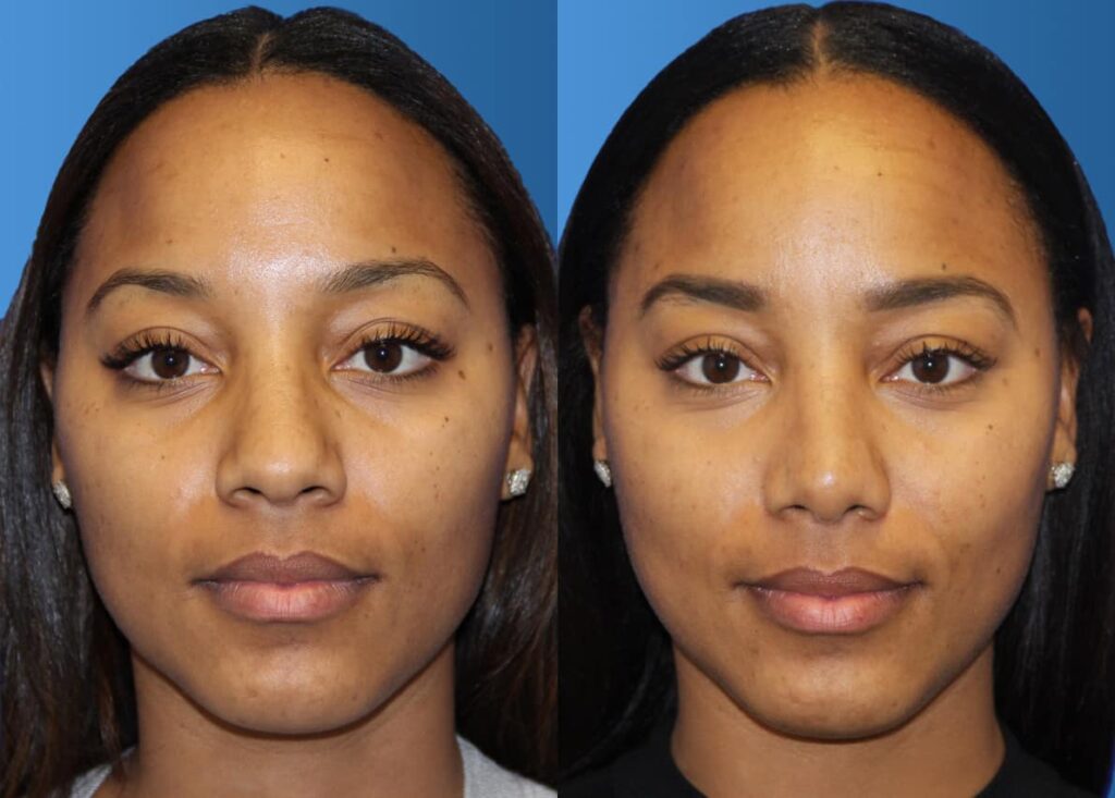 Beverly Hills Plastic Surgeon - Best Beverly Hills Plastic Surgery